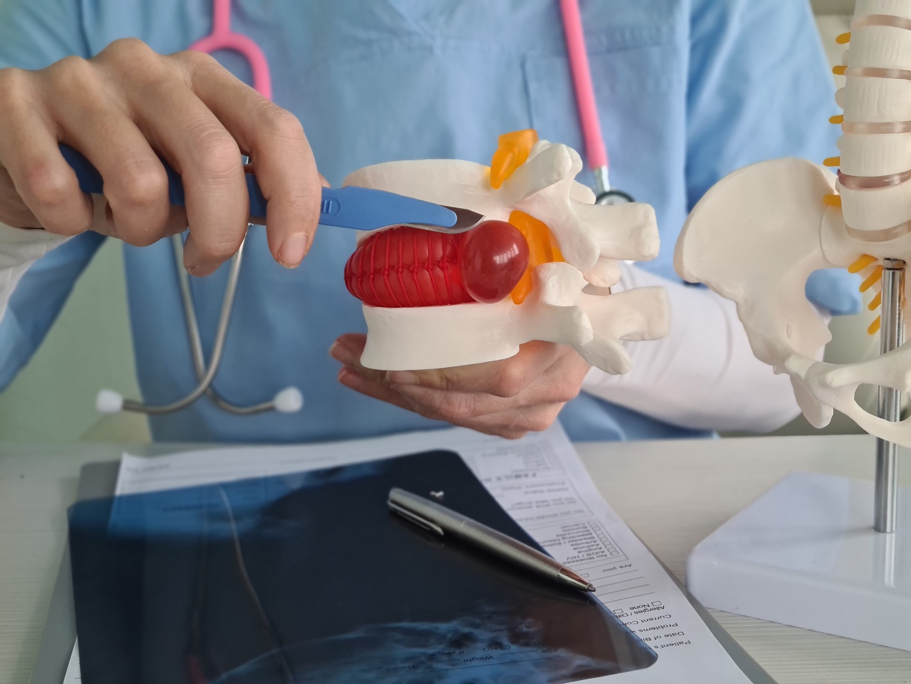 Know About Endoscopic Cervical Discectomy - Dr. Amit Kumar Ghosh